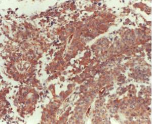 Image Cytometry Diagnostic Laboratory - Immunohistochemistry Analysis