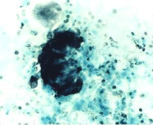 Image Cytometry Diagnostic Laboratory - Immunohistochemistry Analysis