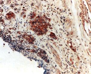 Image Cytometry Diagnostic Laboratory - Immunohistochemistry Analysis