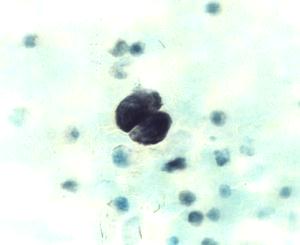 Image Cytometry Diagnostic Laboratory - Immunohistochemistry Analysis