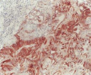 Image Cytometry Diagnostic Laboratory - Immunohistochemistry Analysis