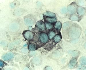 Image Cytometry Diagnostic Laboratory - Immunohistochemistry Analysis