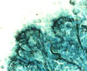 Image Cytometry Diagnostic Laboratory - Immunohistochemistry Analysis
